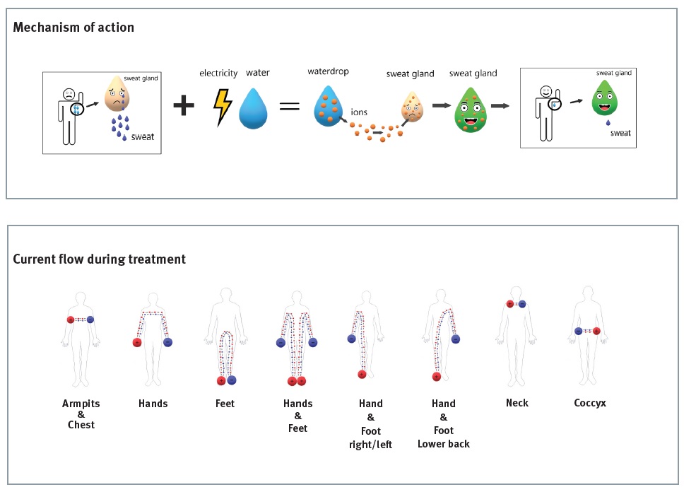 Mechanism of action & application idromed®5 - Dr. Hönle Medizintechnik